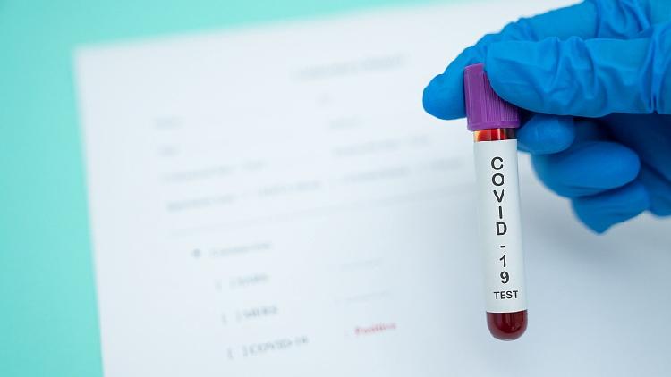 U.S. CDC acknowledges mixing up data of viral, antibody tests - CGTN