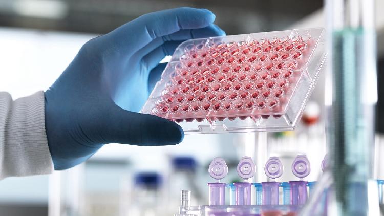 Experts identify steps to improve antibody tests in COVID-19 response ...