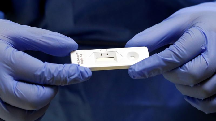 U.S. nods Abbott's rapid COVID-19 test for at-home screenings - CGTN