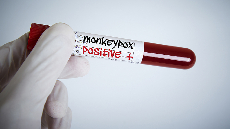China-based researchers develop rapid testing methods for monkeypox - CGTN