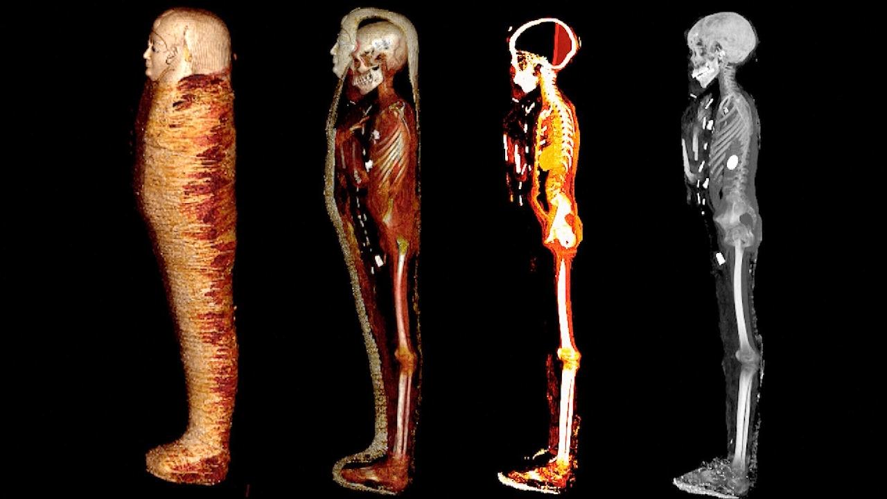 Golden boy mummy's secrets revealed by CT scans - CGTN