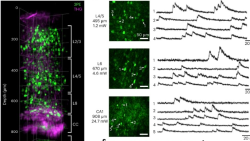 China develops three-photon microscope, capturing deep-brain images - CGTN