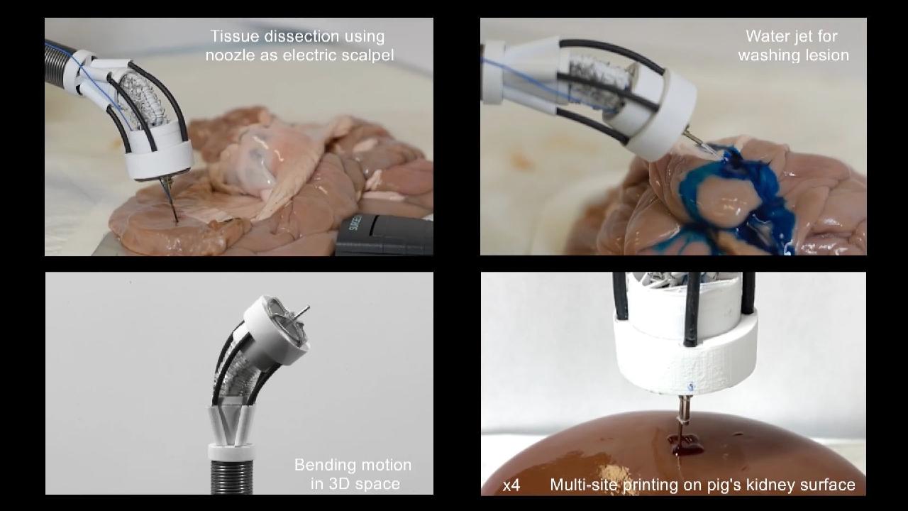 New robot can 3D bioprint inside human body - CGTN