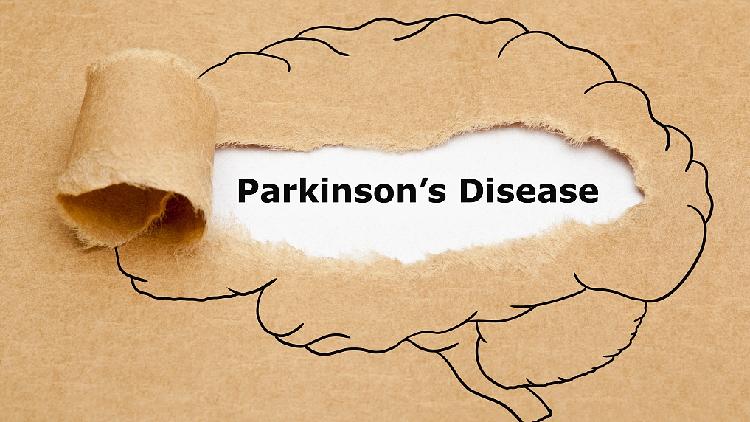 Chinese researchers develop imaging biomarker for Parkinson's disease ...