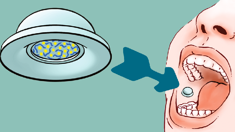 Scientists develop octopus-inspired patch to deliver drugs via cheeks ...