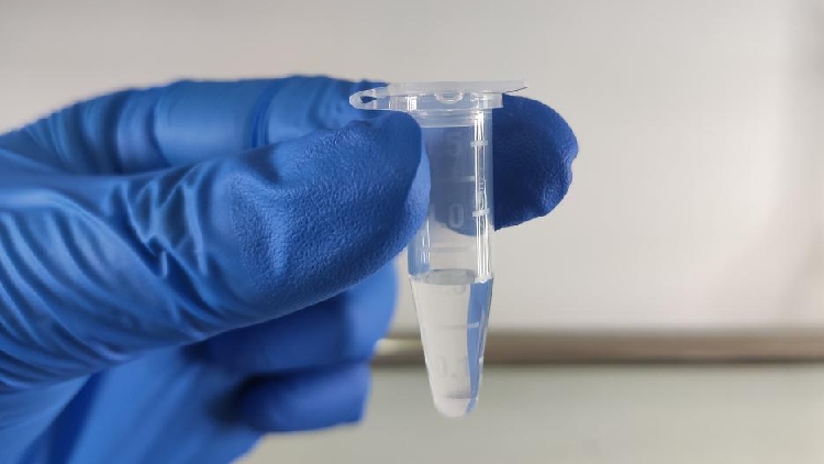 China develops intelligent DNA nano-device for precision thrombolysis ...