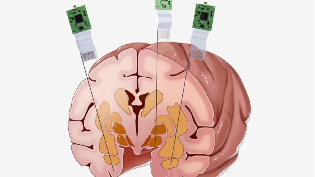 China develops first neural probe to record activity in macaque brain ...