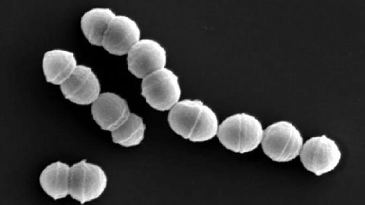 Japan reports over 1,100 cases of 'flesh-eating bacteria' infections - CGTN