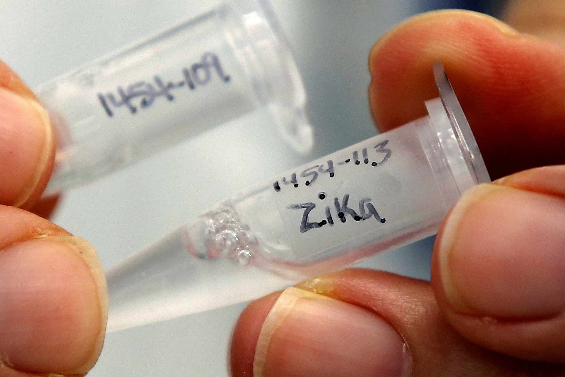 UN report: Zika could cost Latin America, Caribbean $18 billion - CGTN