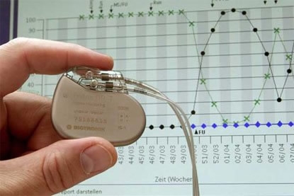 Caution! Devices collecting health data may betray your secrets - CGTN