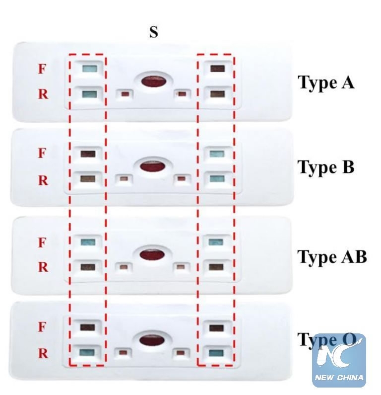 New paper test determines blood type in just 30 seconds: Chinese study ...